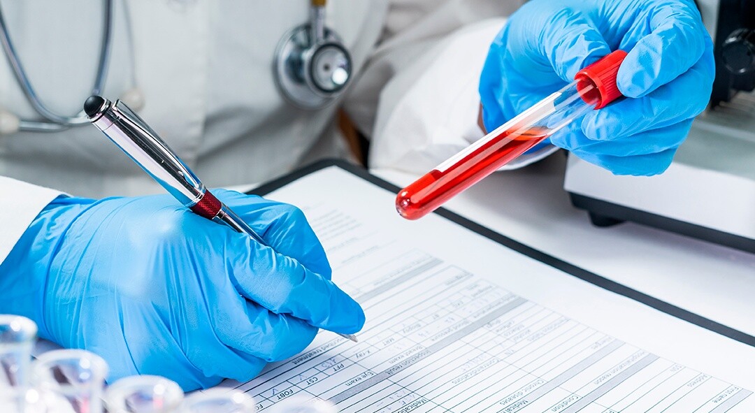 Exames Laboratoriais - Anga Medicina Diagnóstica